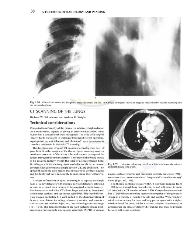 Textbook of Radiology and Imaging (Vol. 1) ( PDFDrive ).pdf