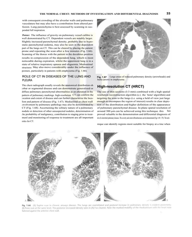 Textbook of Radiology and Imaging (Vol. 1) ( PDFDrive ).pdf