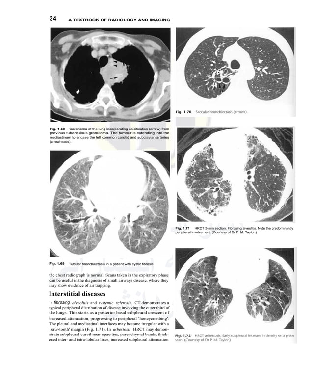 Textbook of Radiology and Imaging (Vol. 1) ( PDFDrive ).pdf