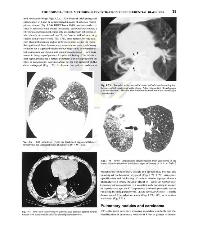 Textbook of Radiology and Imaging (Vol. 1) ( PDFDrive ).pdf