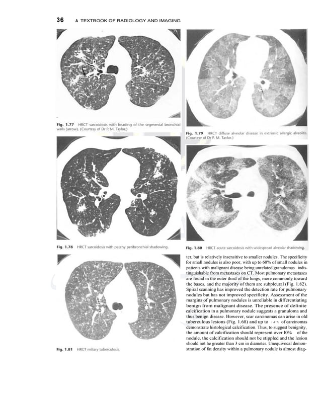 Textbook of Radiology and Imaging (Vol. 1) ( PDFDrive ).pdf