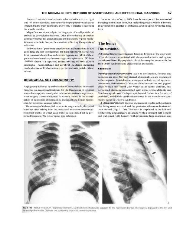Textbook of Radiology and Imaging (Vol. 1) ( PDFDrive ).pdf