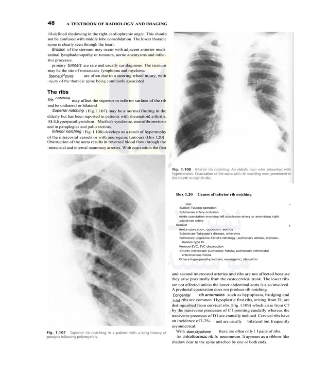Textbook of Radiology and Imaging (Vol. 1) ( PDFDrive ).pdf