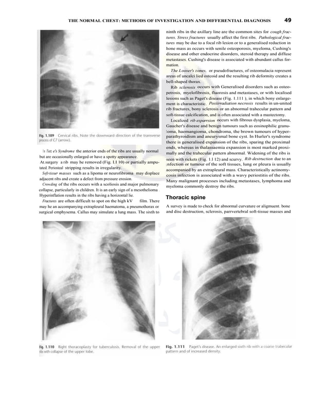 Textbook of Radiology and Imaging (Vol. 1) ( PDFDrive ).pdf