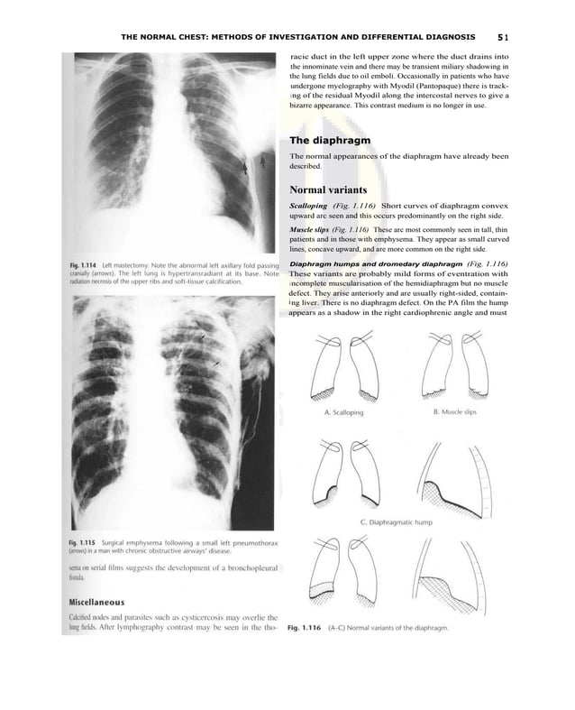 Textbook of Radiology and Imaging (Vol. 1) ( PDFDrive ).pdf