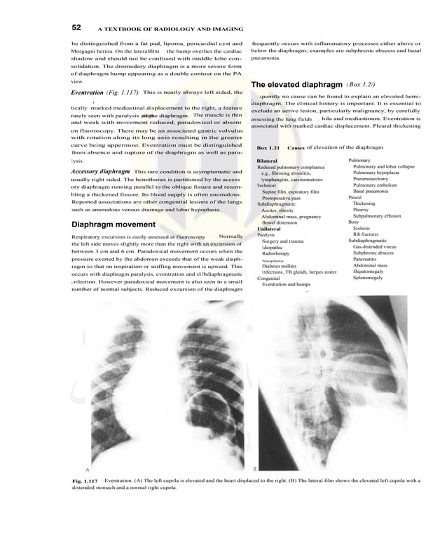 Textbook of Radiology and Imaging (Vol. 1) ( PDFDrive ).pdf