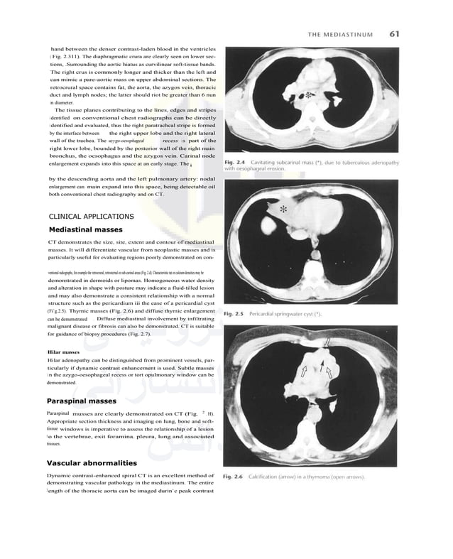 Textbook of Radiology and Imaging (Vol. 1) ( PDFDrive ).pdf