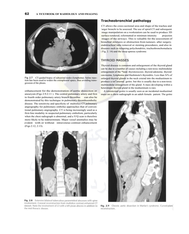 Textbook of Radiology and Imaging (Vol. 1) ( PDFDrive ).pdf