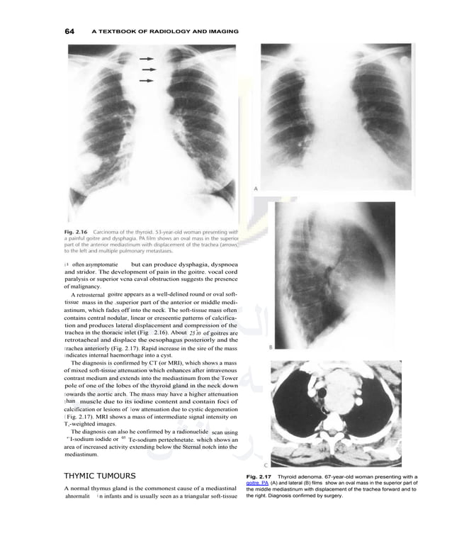Textbook of Radiology and Imaging (Vol. 1) ( PDFDrive ).pdf