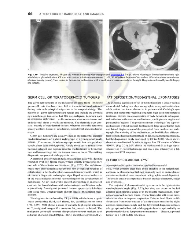 Textbook of Radiology and Imaging (Vol. 1) ( PDFDrive ).pdf