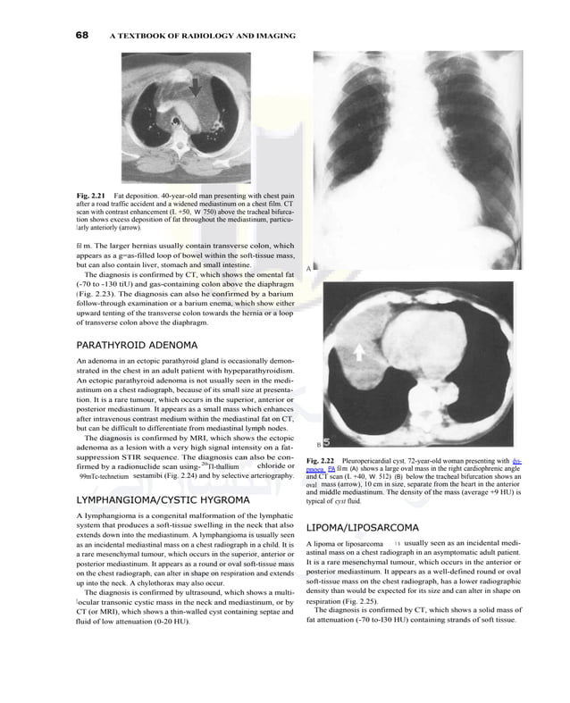 Textbook of Radiology and Imaging (Vol. 1) ( PDFDrive ).pdf