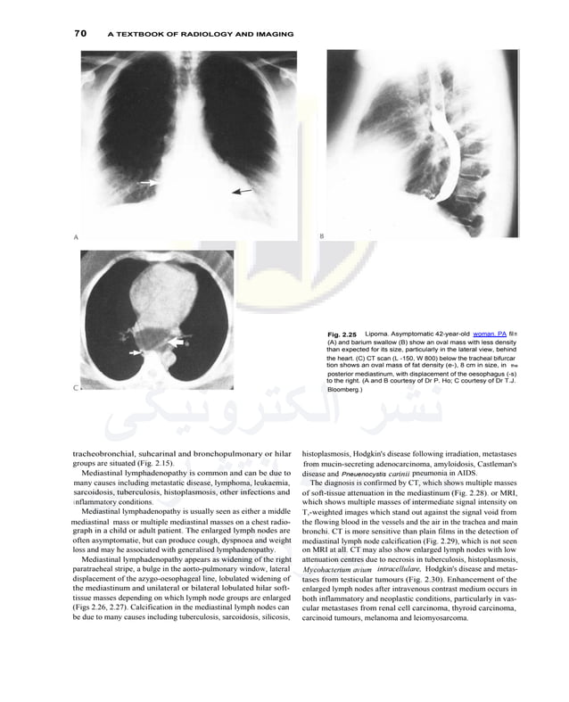 Textbook of Radiology and Imaging (Vol. 1) ( PDFDrive ).pdf