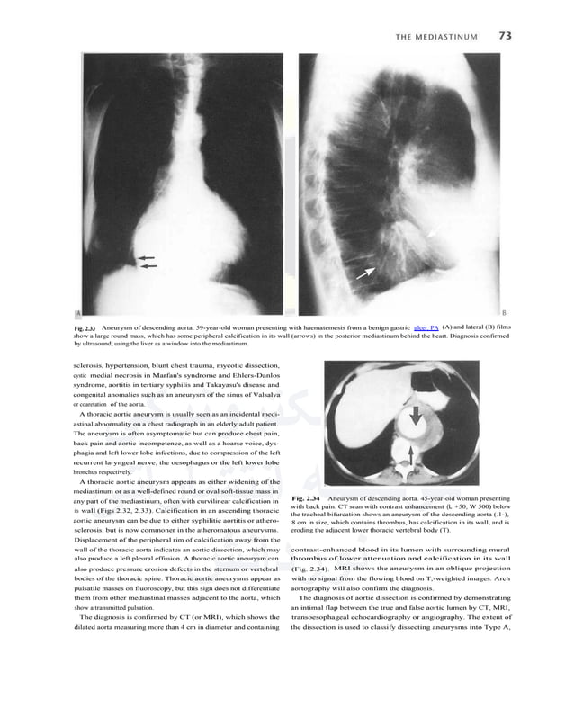 Textbook of Radiology and Imaging (Vol. 1) ( PDFDrive ).pdf