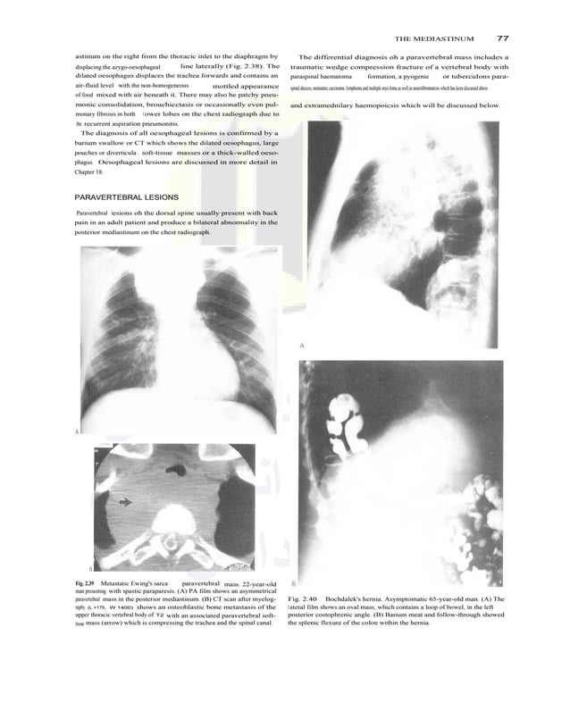 Textbook of Radiology and Imaging (Vol. 1) ( PDFDrive ).pdf