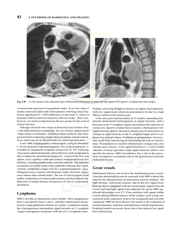 Textbook of Radiology and Imaging (Vol. 1) ( PDFDrive ).pdf