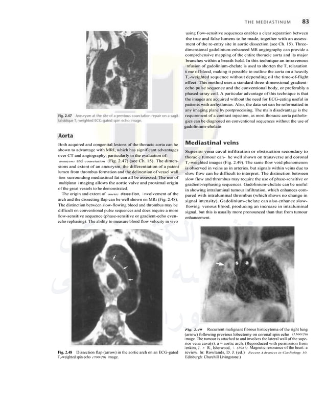 Textbook of Radiology and Imaging (Vol. 1) ( PDFDrive ).pdf