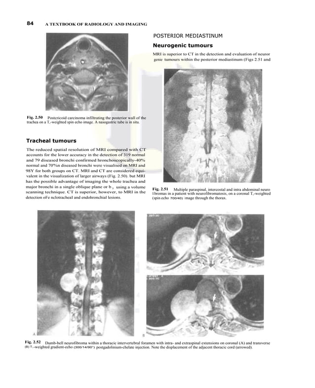 Textbook of Radiology and Imaging (Vol. 1) ( PDFDrive ).pdf