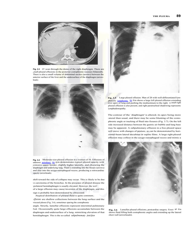 Textbook of Radiology and Imaging (Vol. 1) ( PDFDrive ).pdf
