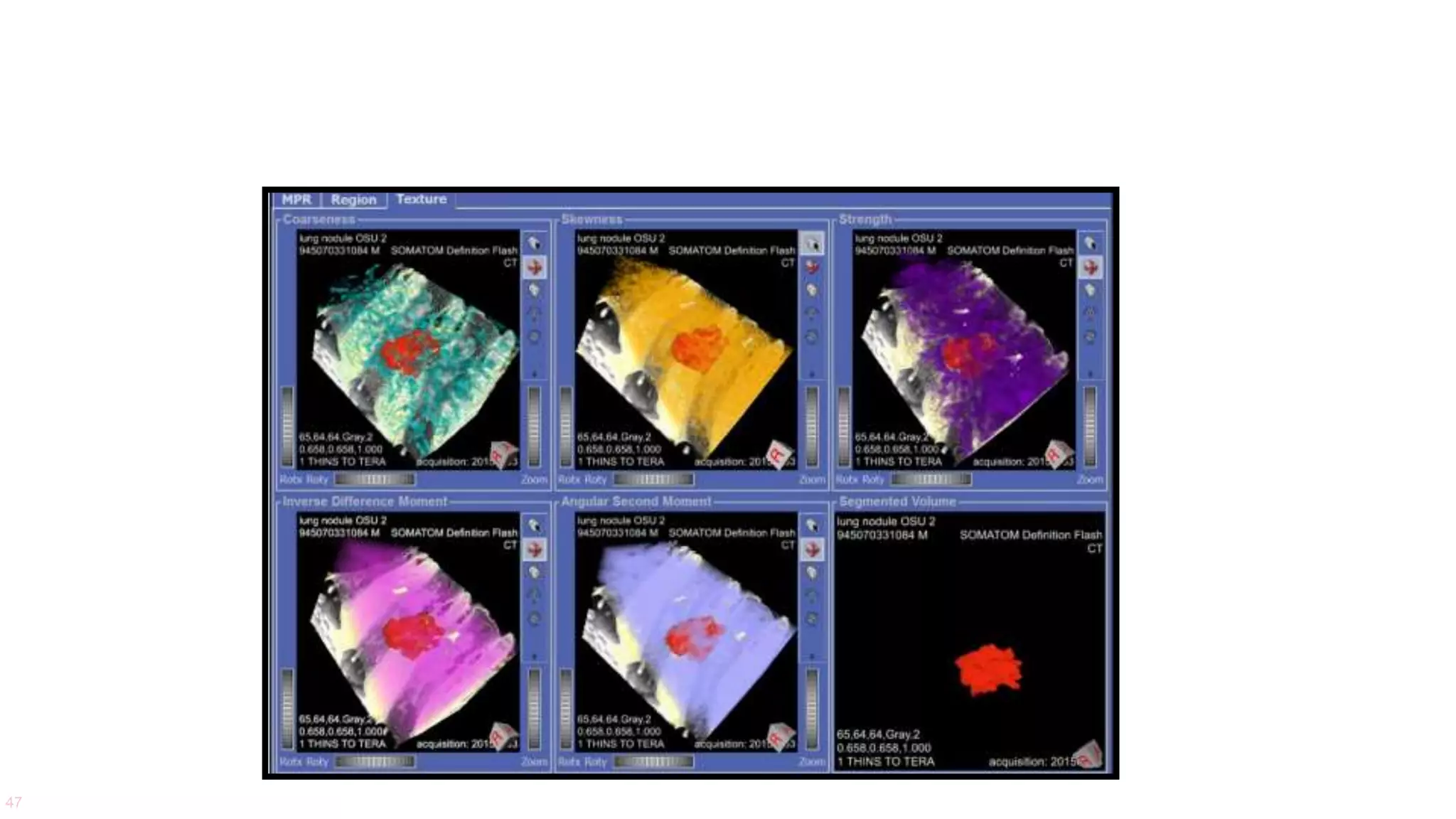 Introduction to Machine Learning and Texture Analysis for Lesion Characterization | PPTX