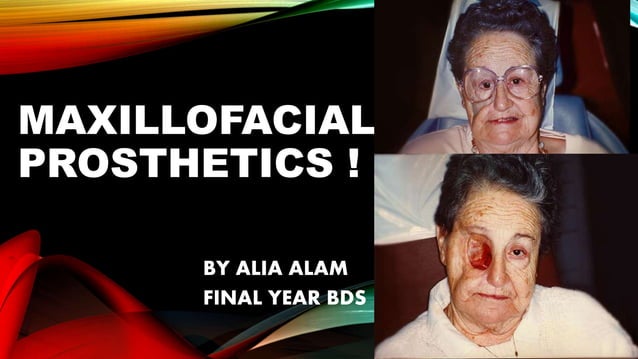 maxillofacial prosthetics | PPTX