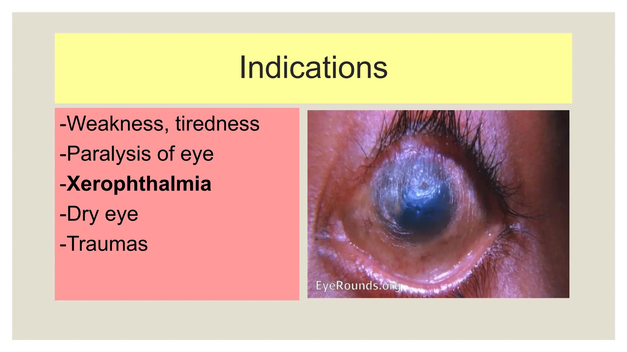 Kriyakalpa - Ayurvedic Eye treatments.pptx