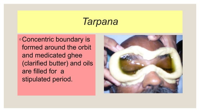 Kriyakalpa - Ayurvedic Eye treatments.pptx | Skin Care | Beauty