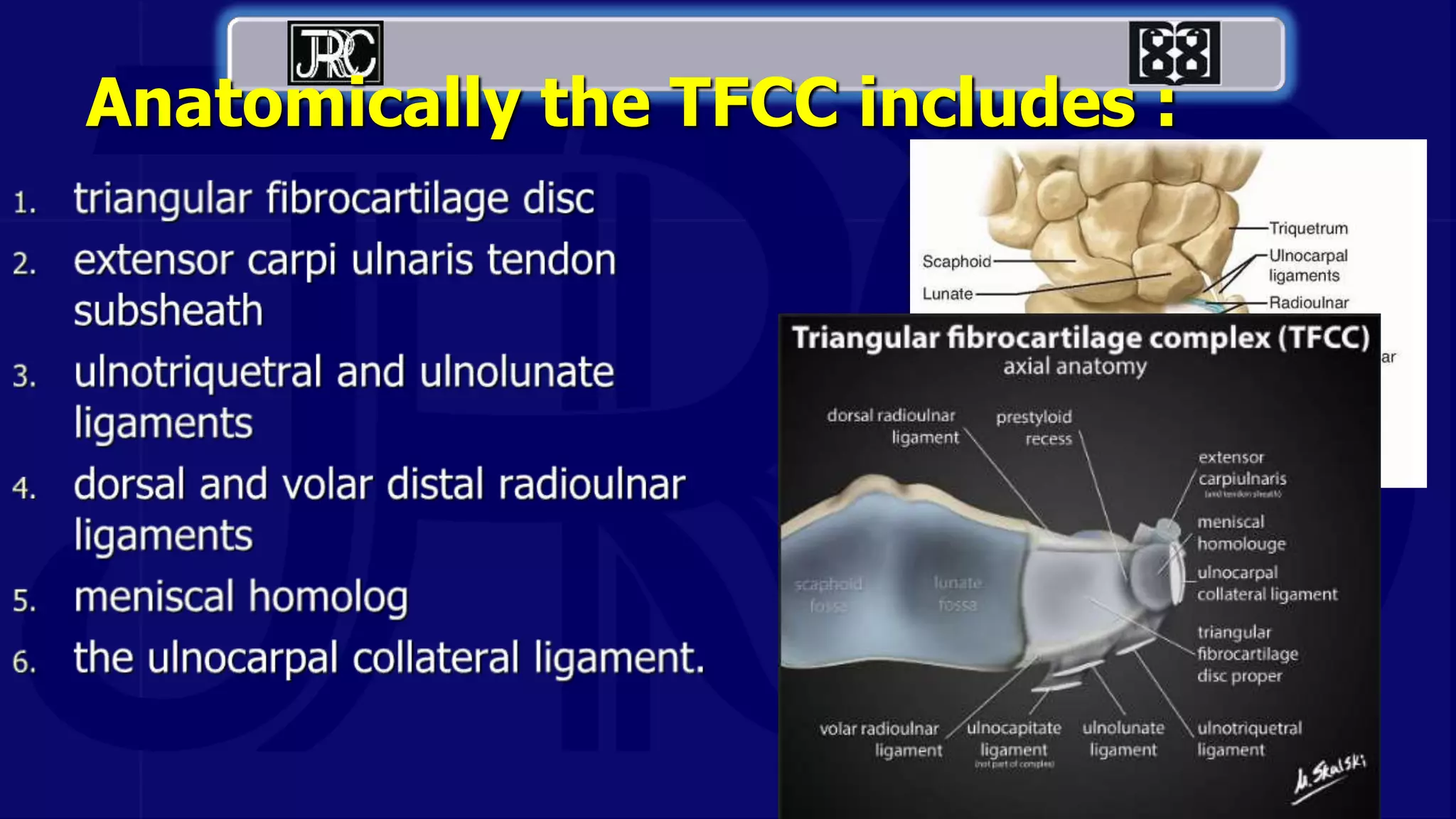 TFCC (Triangular fibro cartilage complex) Injury | PPT