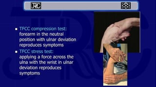 TFCC (Triangular fibro cartilage complex) Injury | PPT