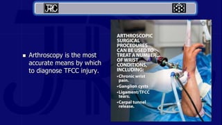 TFCC (Triangular fibro cartilage complex) Injury | PPT