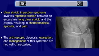 TFCC (Triangular fibro cartilage complex) Injury | PPT