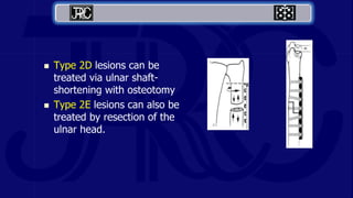 TFCC (Triangular fibro cartilage complex) Injury | PPT