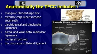 TFCC (Triangular fibro cartilage complex) Injury | PPT
