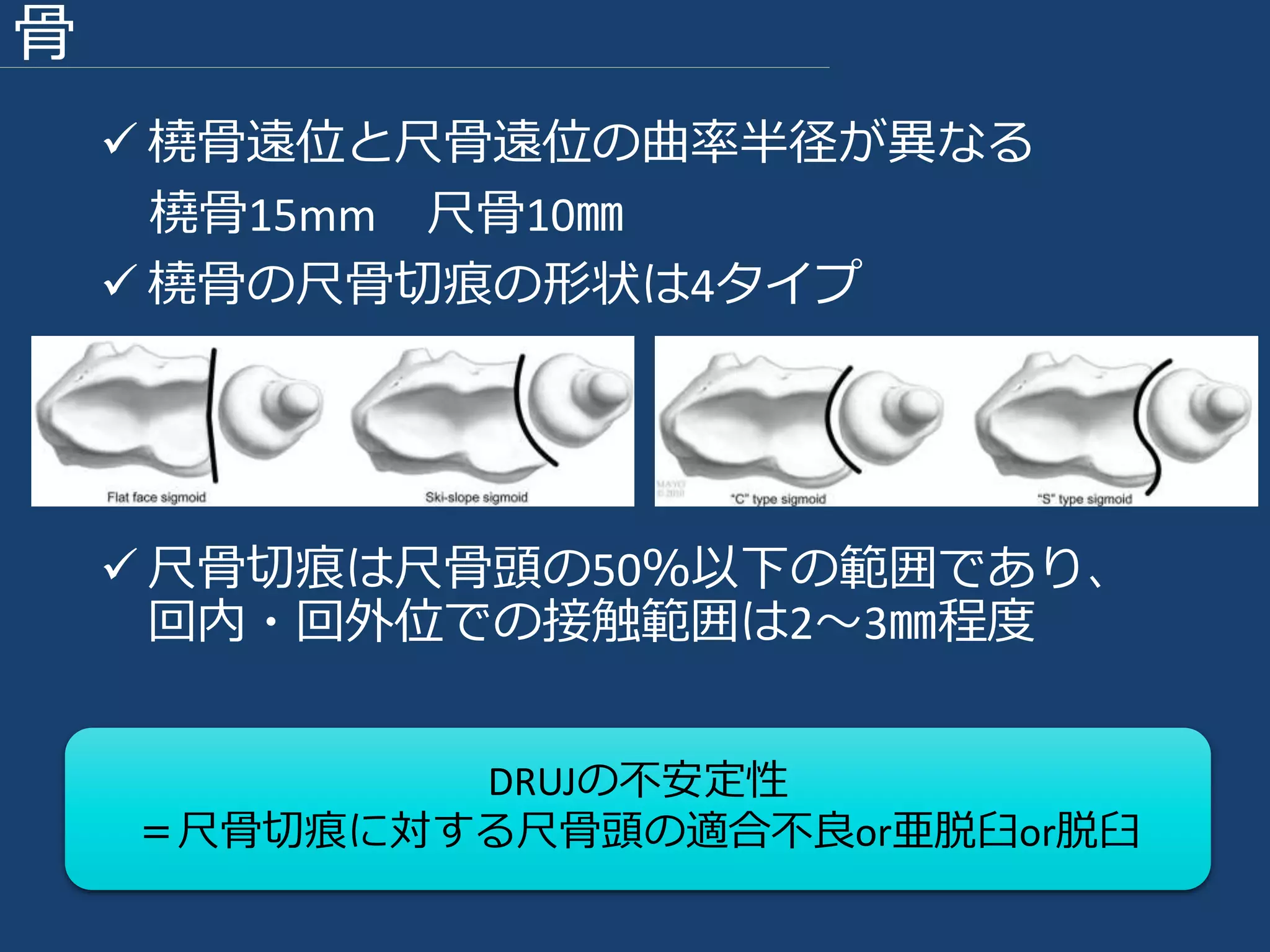 DRUJ(遠位橈尺関節)の不安定性とTFCC(三角線維軟骨複合体)損傷に関する文献まとめ | PPTX