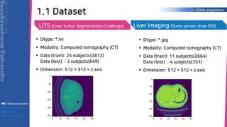 Liver segmentation using U-net: Practical issues @ SNU-TF | PDF