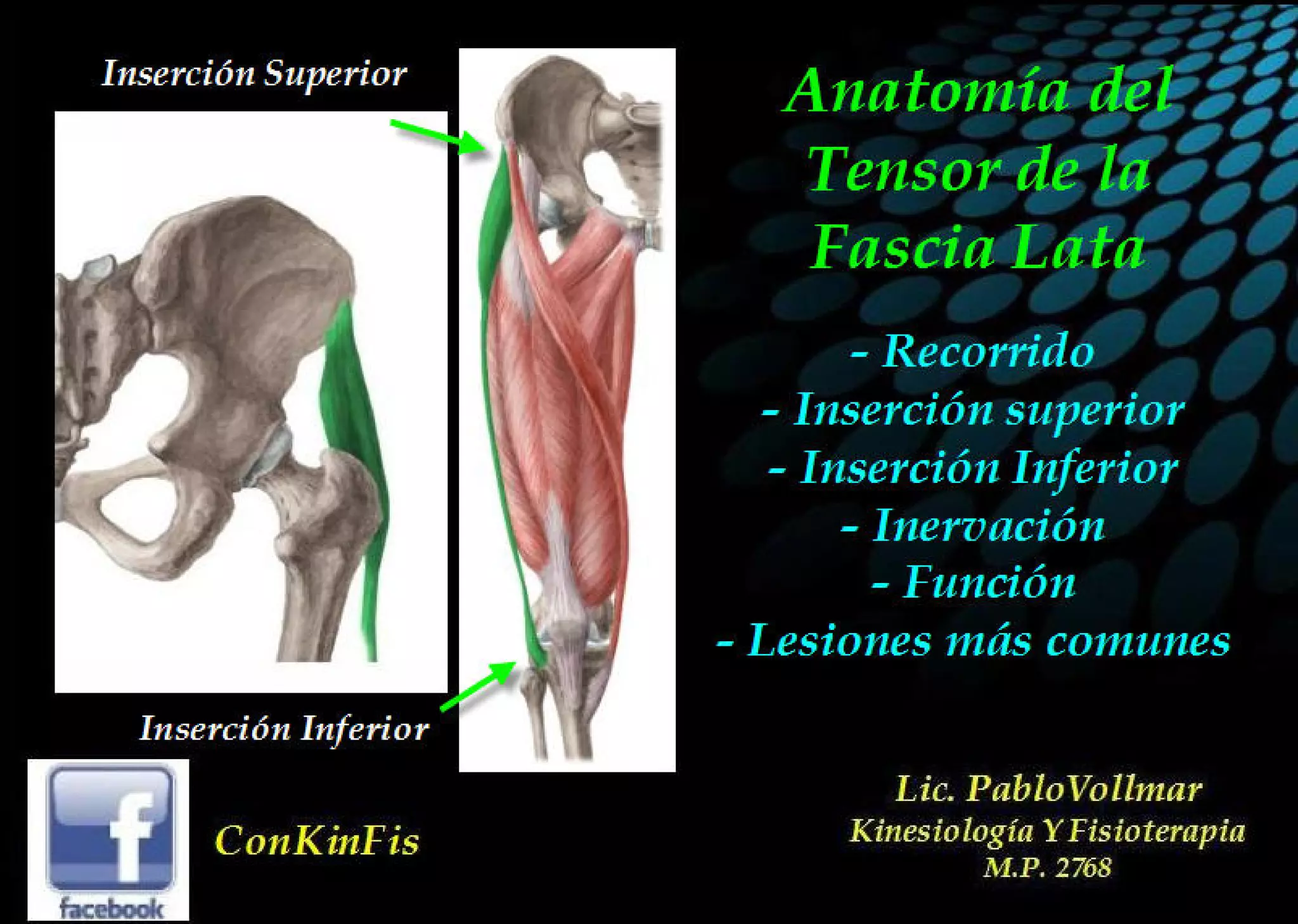 Anatomía De La Fascia Lata