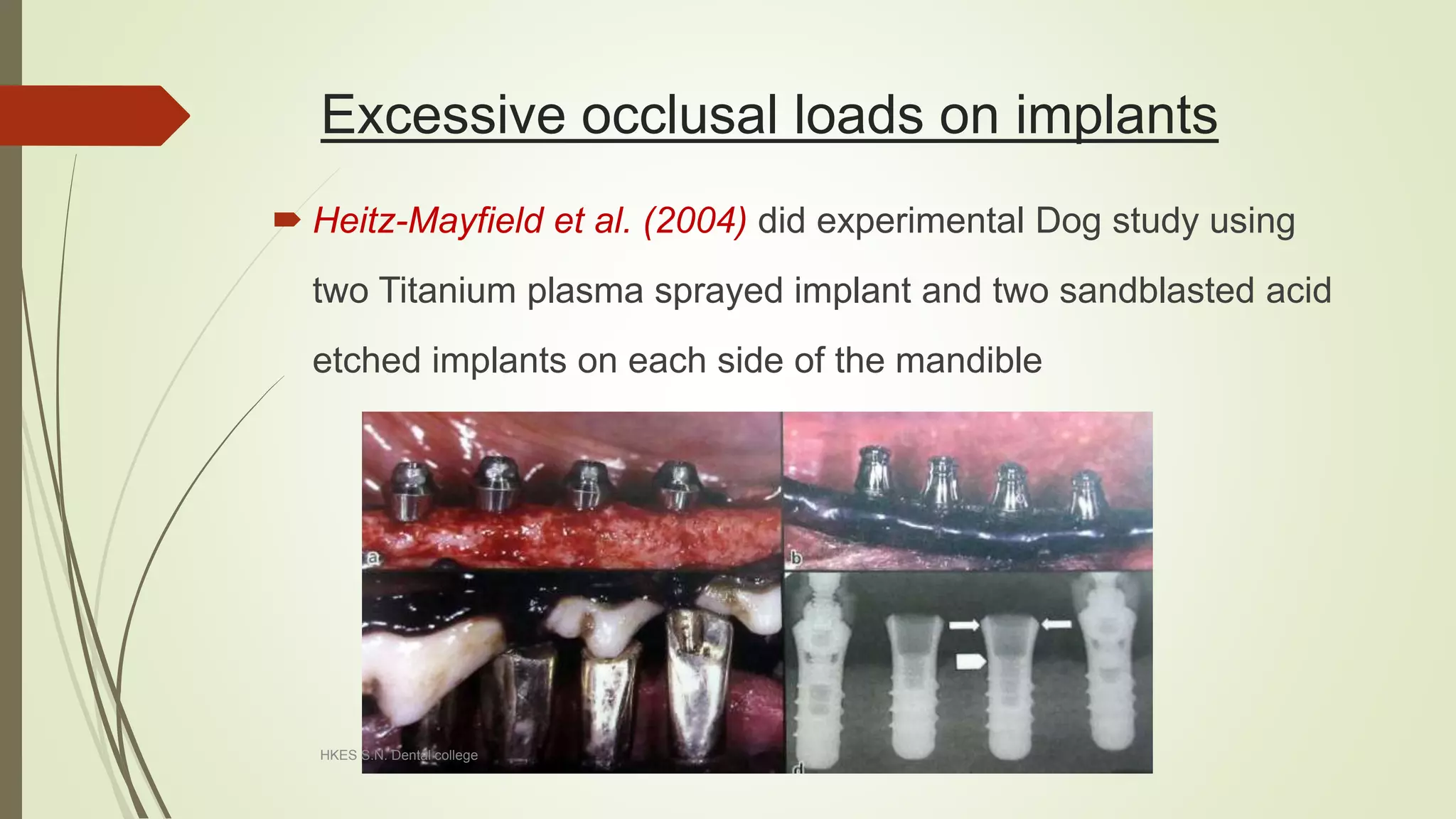Trauma from occlusion (Including TFO around dental implants) | PPTX
