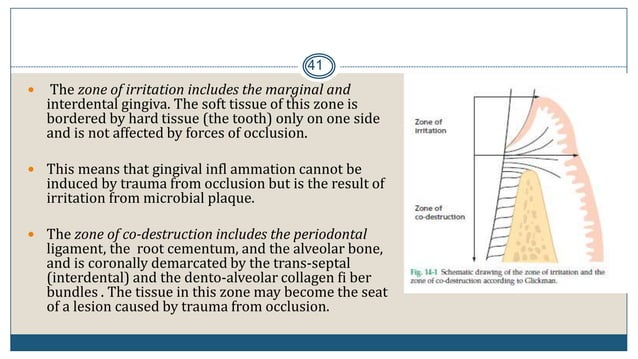 trauma from occlusion | PPTX | Dental Health | Diseases and Conditions