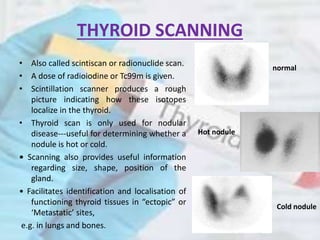 Thyroid Function Tests | PPTX