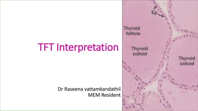 TFT interpretation- TSH, T4, T3, TPO Antibodies.pptx | Thyroid ...