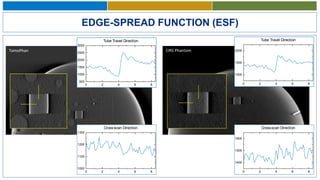 Measuring Spatial Resolution in Digital Breast Tomosynthesis | PPT