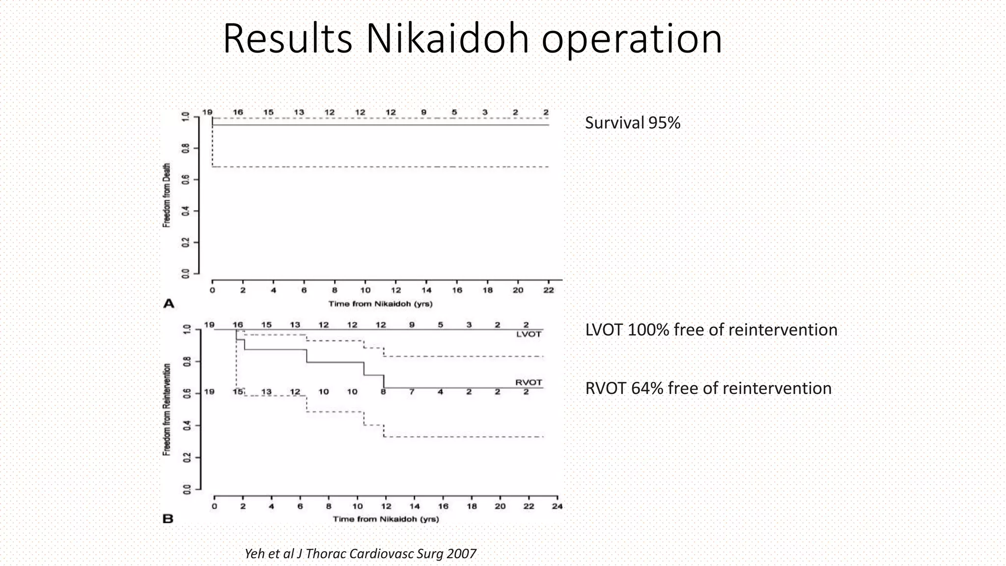 Transposition of great arteries with lvoto management | PPTX