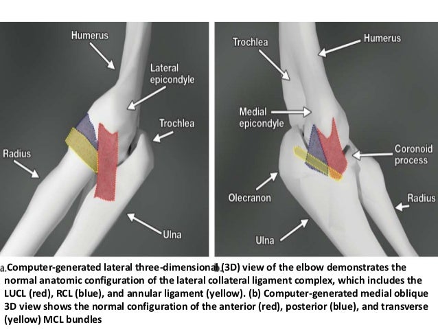 Elbow injury