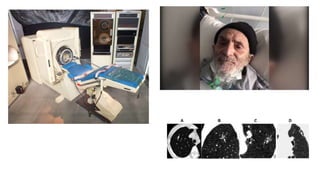 Erkan Kaba TGCD 2021 Segmentektomi | PPT