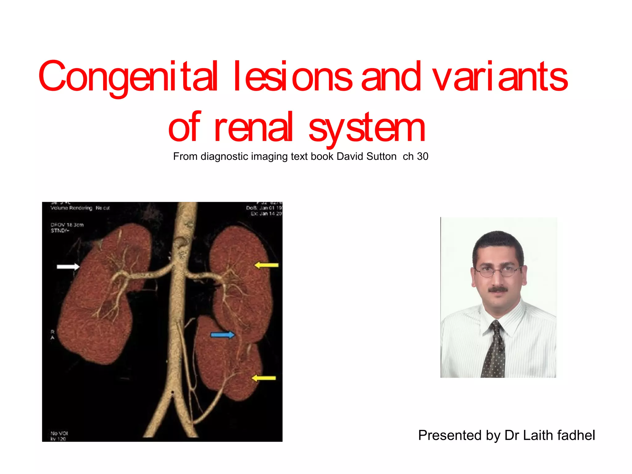 Congenital lesions and variants of renal system | PPT