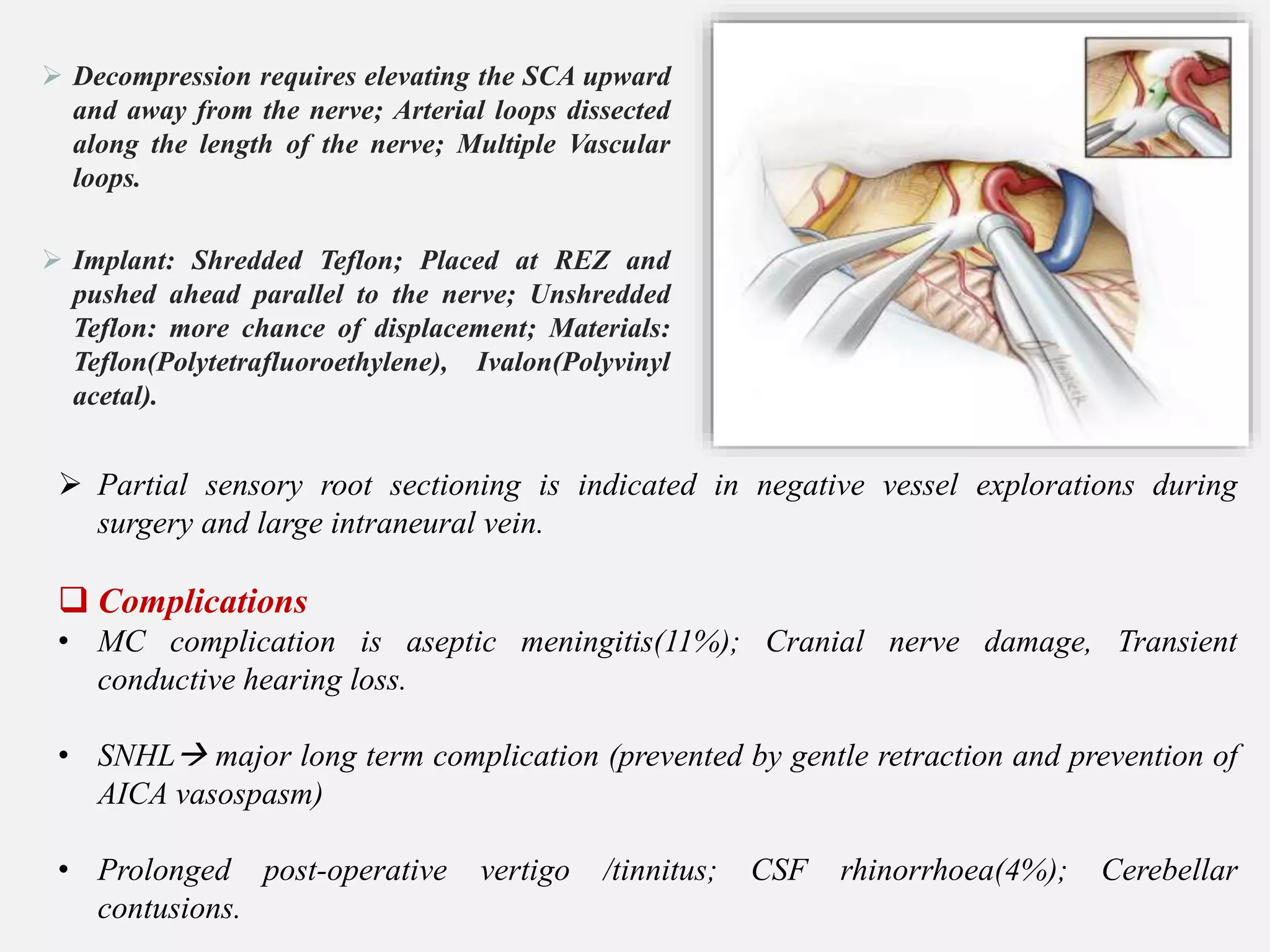 Trigeminal neuralgia | PPTX | Ear, Nose and Throat Conditions ...