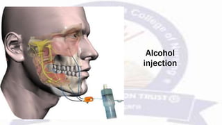 TGN.pptx trigeminal neuralgia achronic neurological disorder of sensory ...