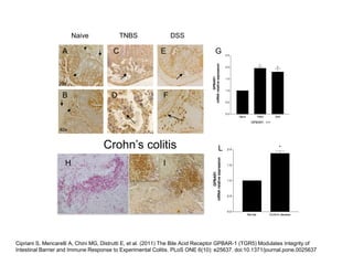 Tgr5 and intestinal mucosa | PPTX