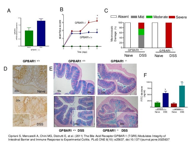 TGR5 (GPBAR1) and intestinal immunity