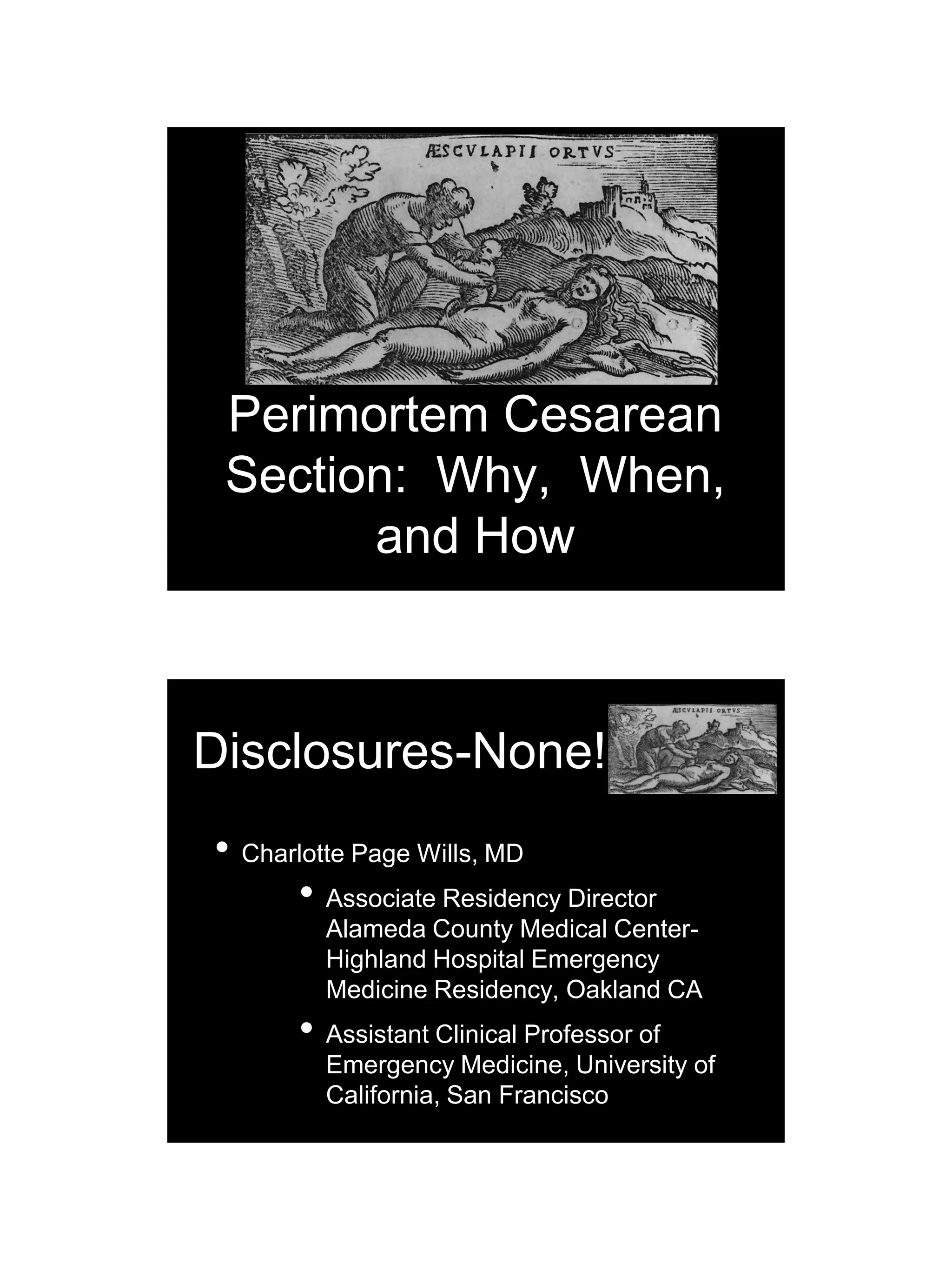 Th 229-post-mortem-c-section-perimortem1 | PDF