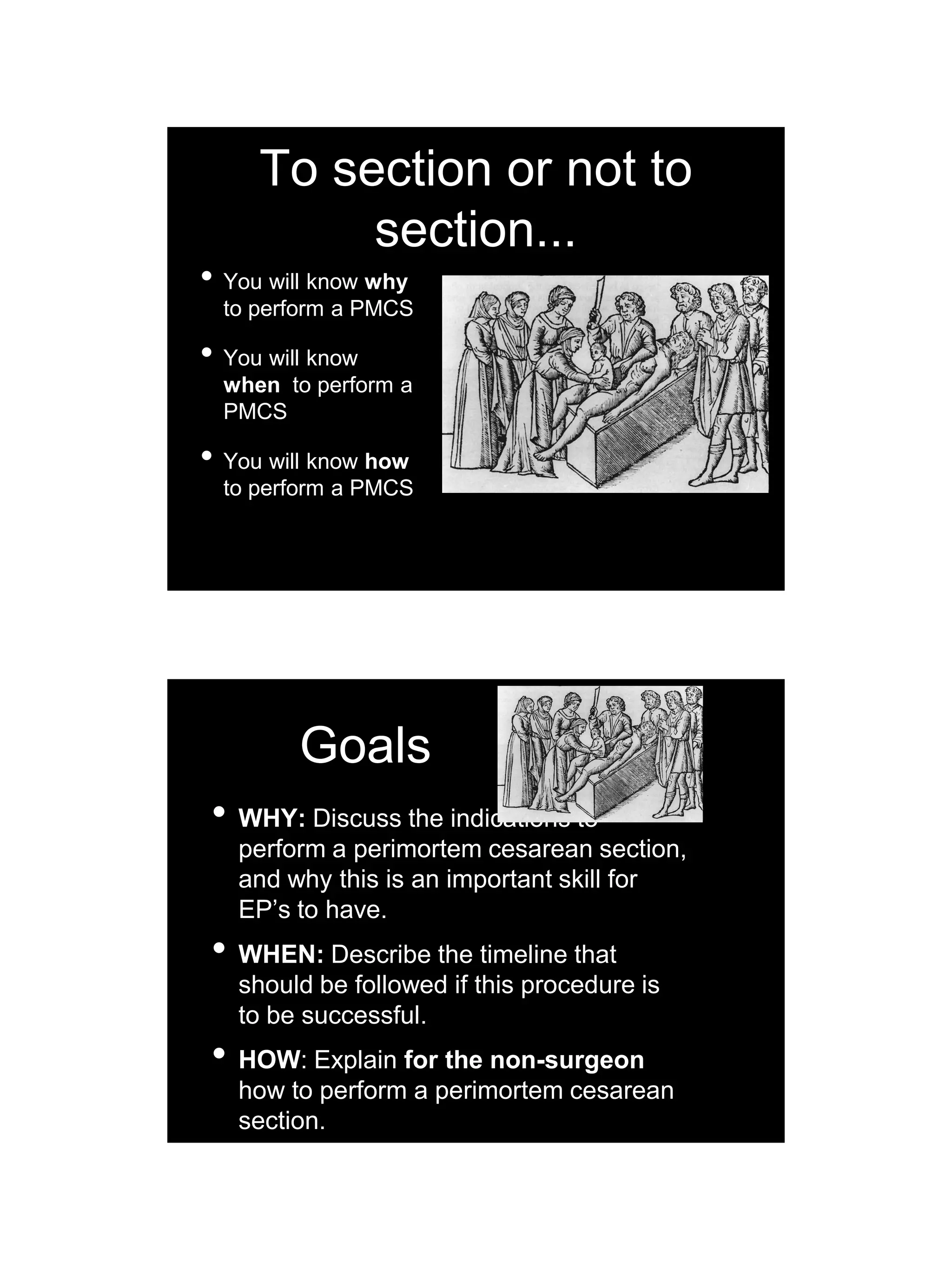 Th 229-post-mortem-c-section-perimortem1 | PDF